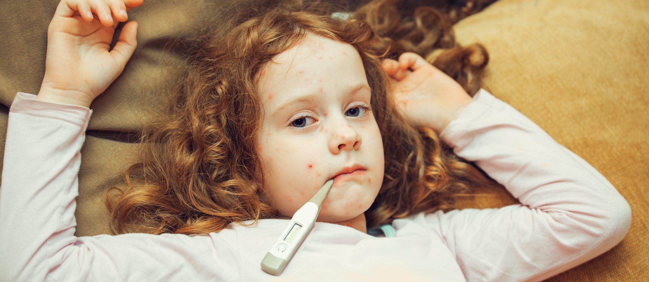 Chicken Pox | Urgent Team - Family of Urgent Care and Walk-in Centers